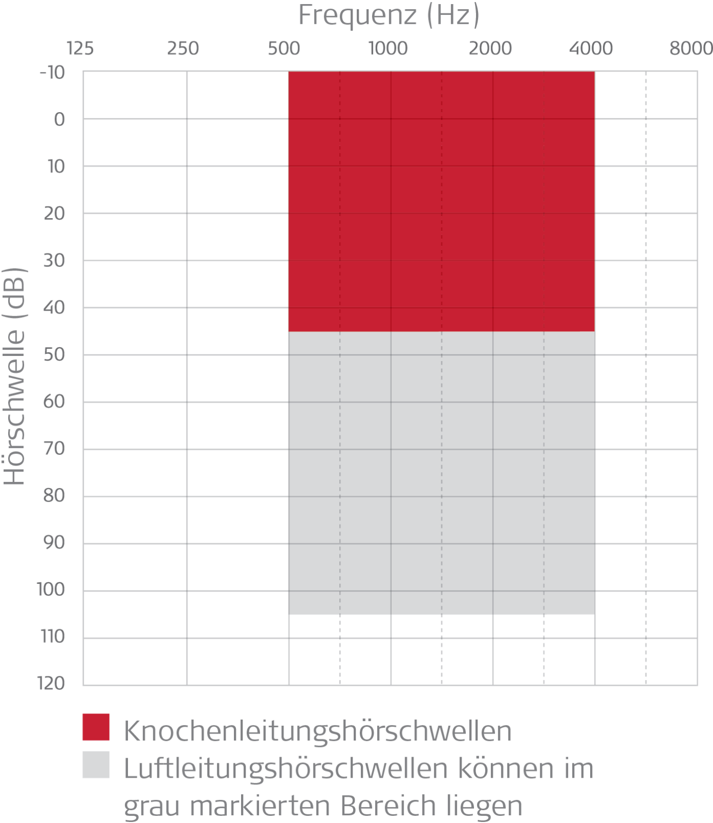 BONEBRIDGE Bone Conduction Implant - hearbetter