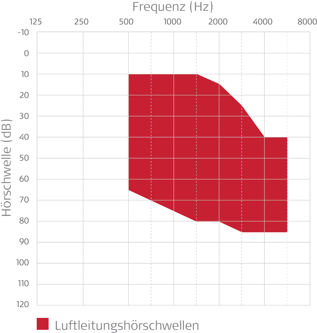Middle Ear Implant VIBRANT SOUNDBRIDGE - hearbetter