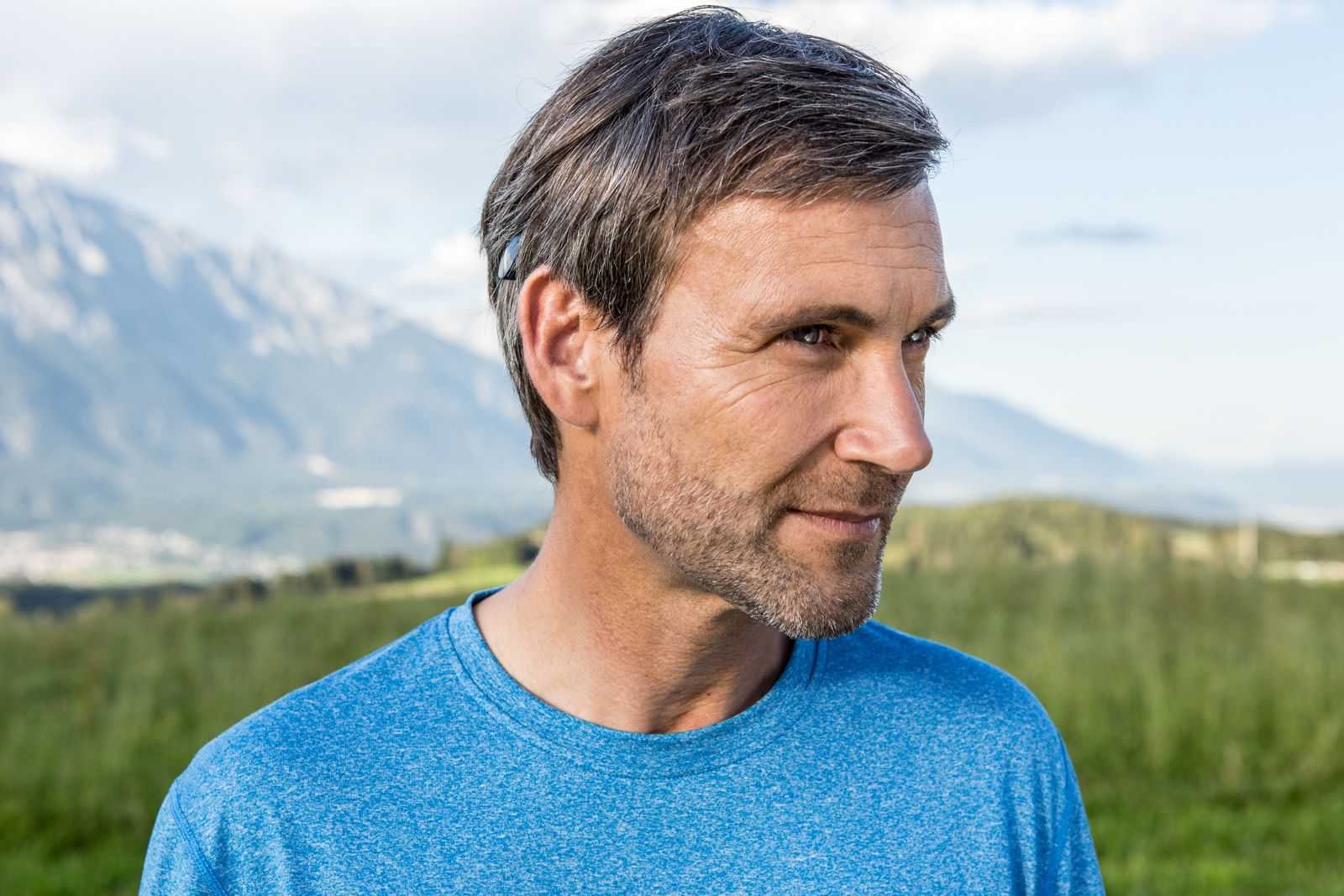 Middle Ear Implant VIBRANT SOUNDBRIDGE - hearbetter