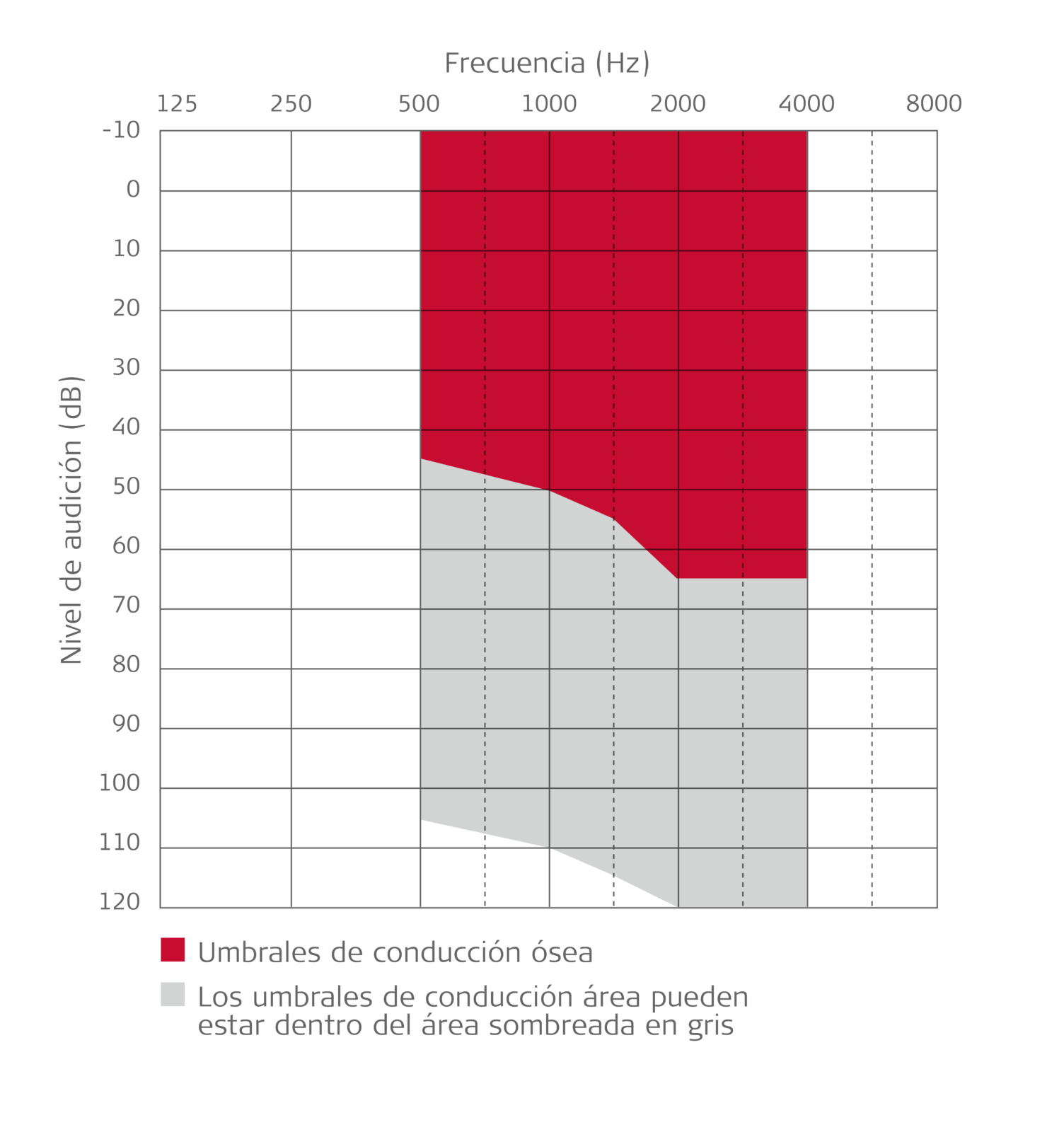 Implante de oído medio VIBRANT SOUNDBRIDGE - hearbetter