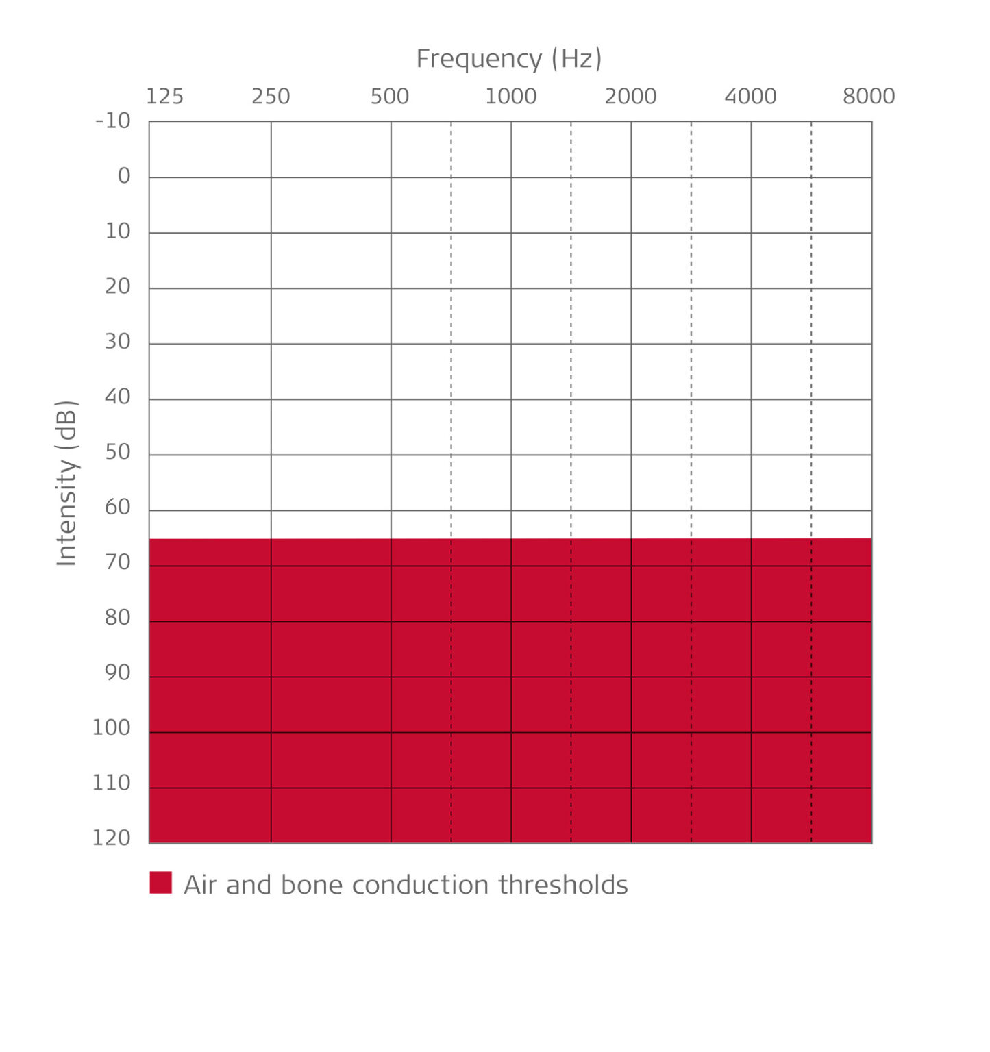 Severe to profound sensorineural hearing loss - hearbetter