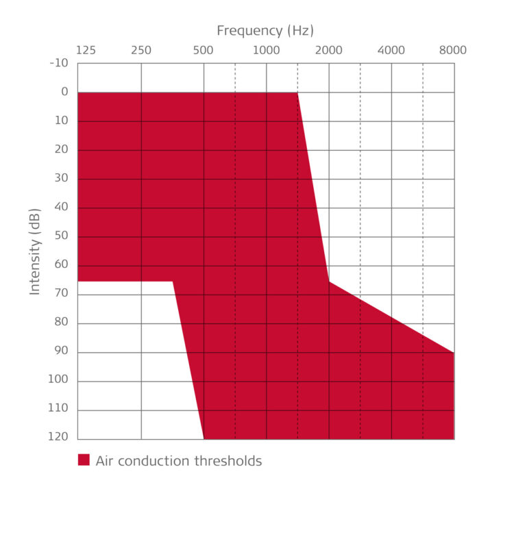 Partial deafness/High frequency sensorineural hearing loss - hearbetter